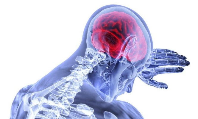 What Exactly Does the "Mild" in Mild Traumatic Brain Injury Mean?